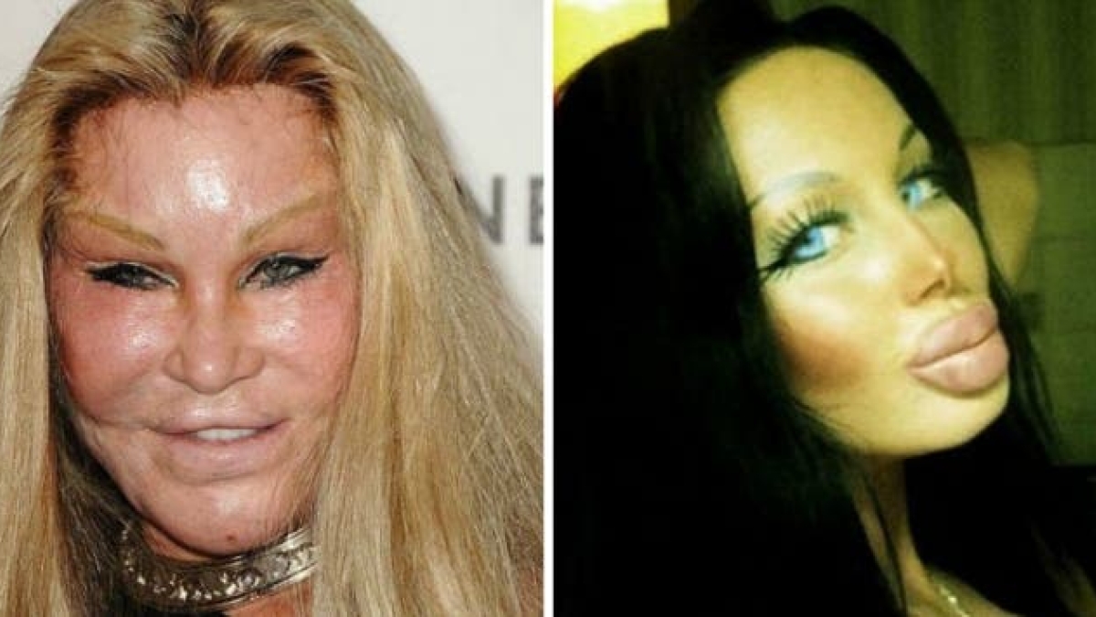 15 completely failed cosmetic surgeries