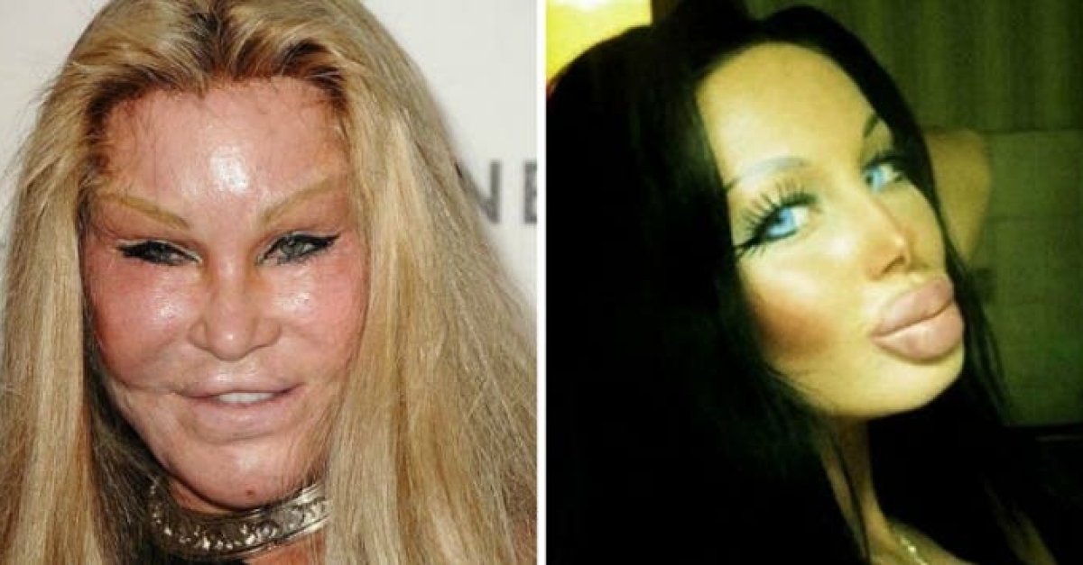 15 completely failed cosmetic surgeries