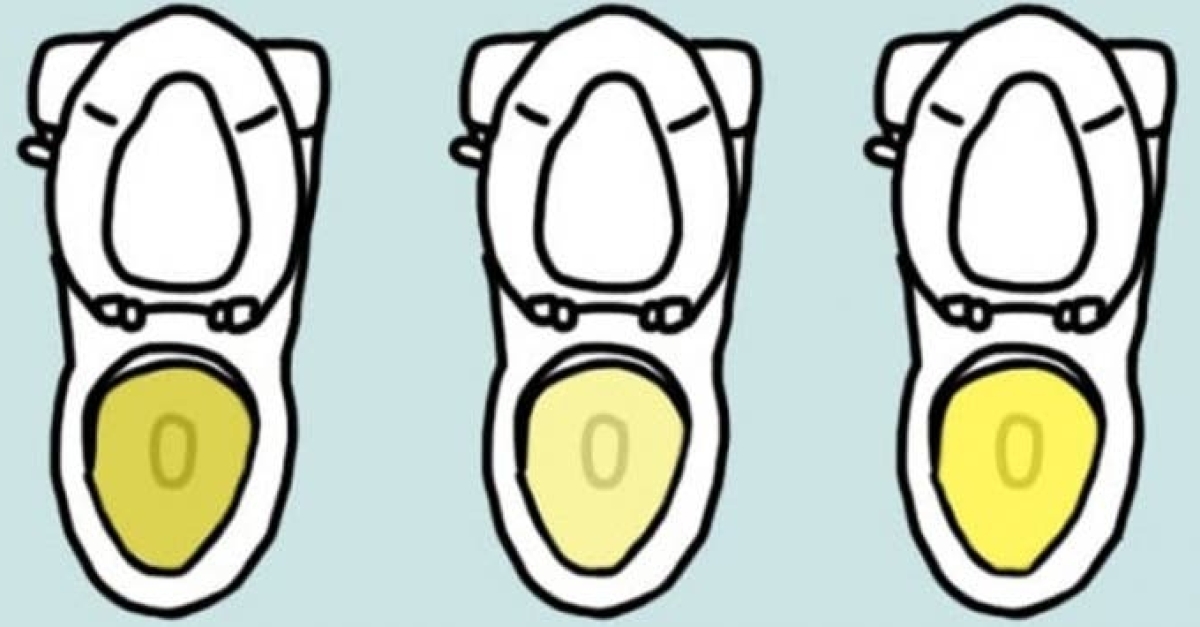 The color of your urine says a lot about your health...Here's what you ...