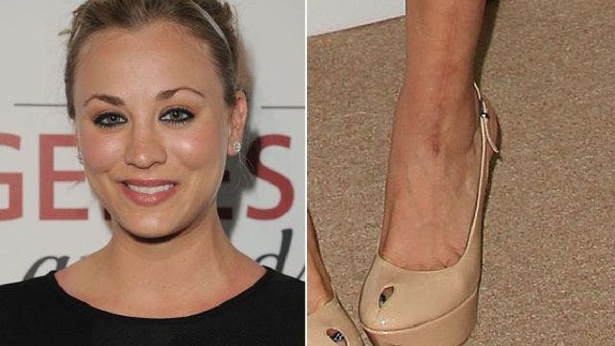 These 15 celebrities reveal the reasons for their scars: Here are their ...