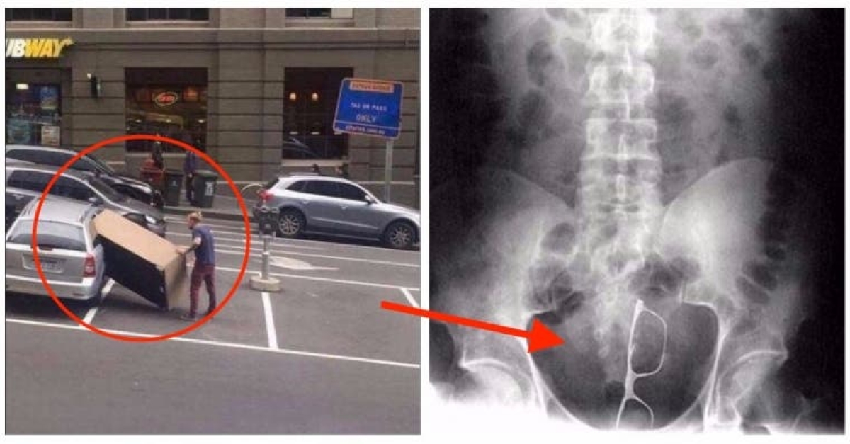 23 baffling photos that will make you wonder what's wrong with people