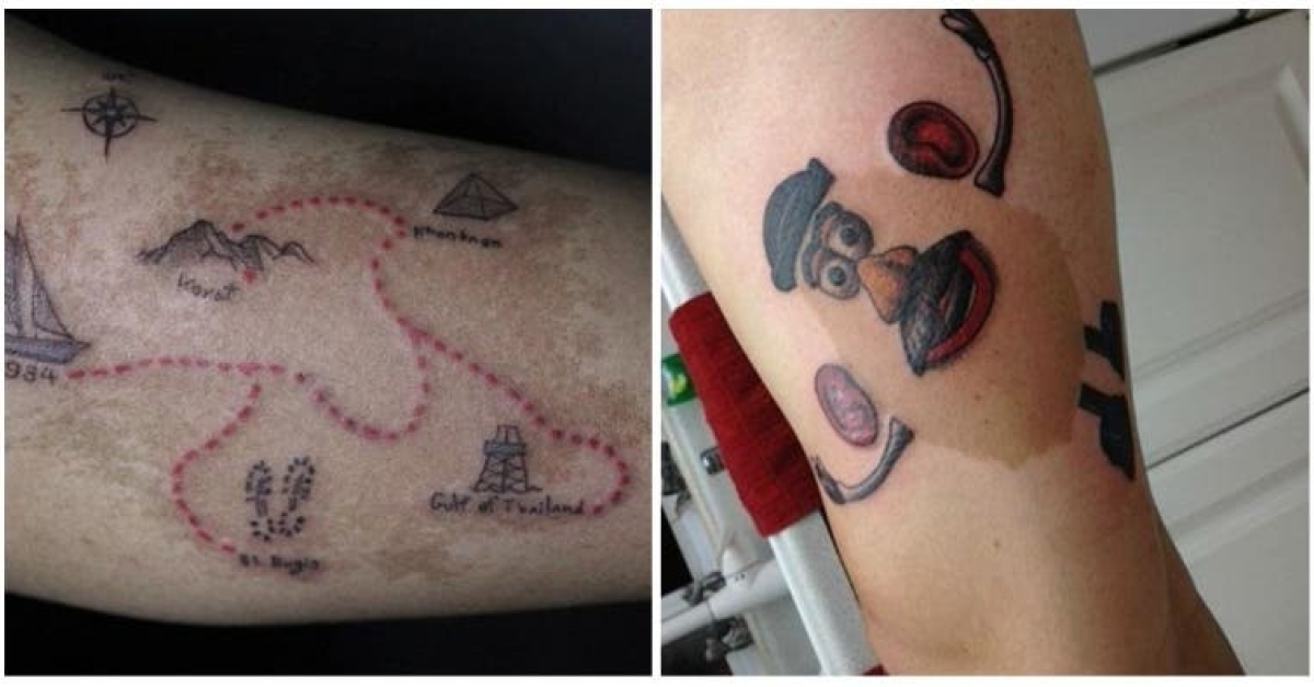 14 tattoos that turned a birthmark into a work of art