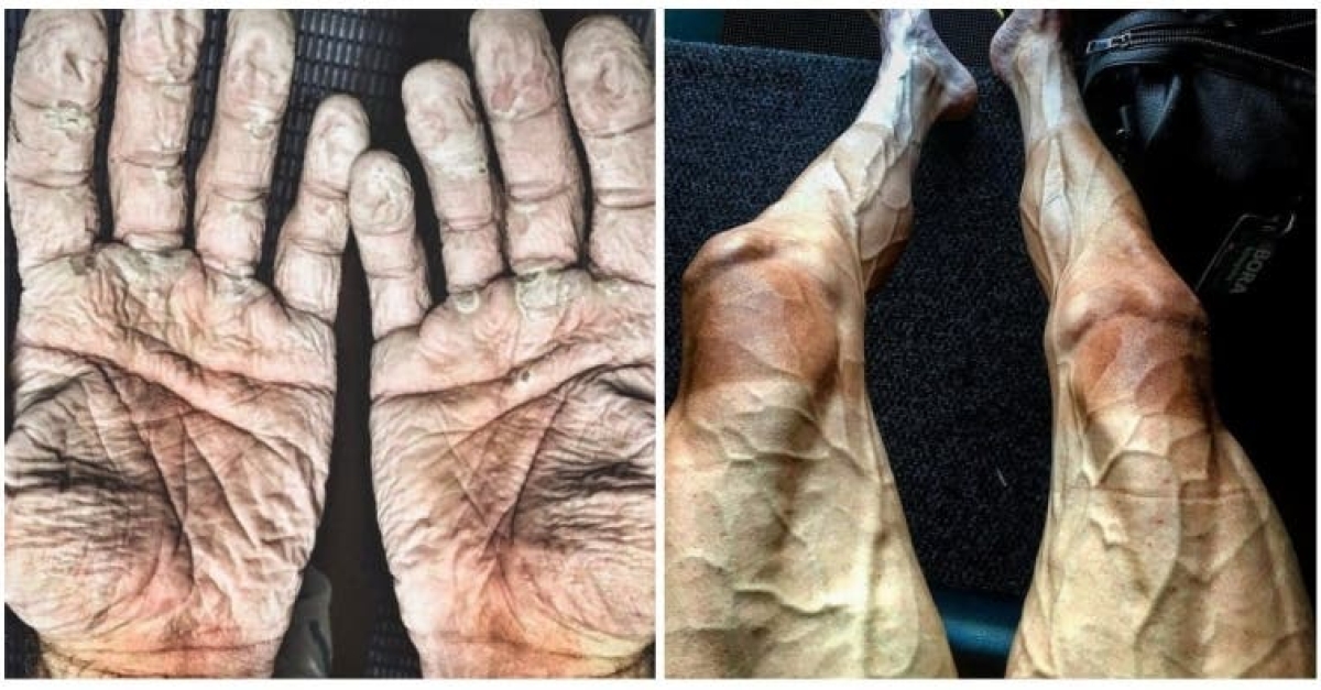 14 people whose grit and determination allowed them to achieve ...