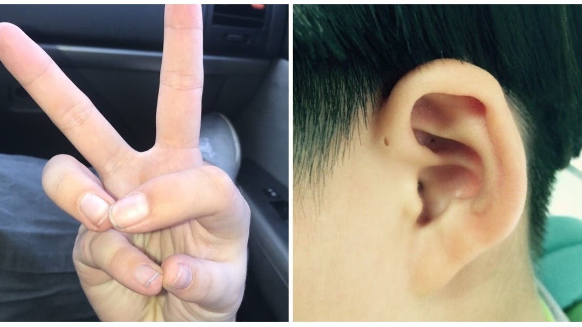 17 people with interesting unique physical qualities