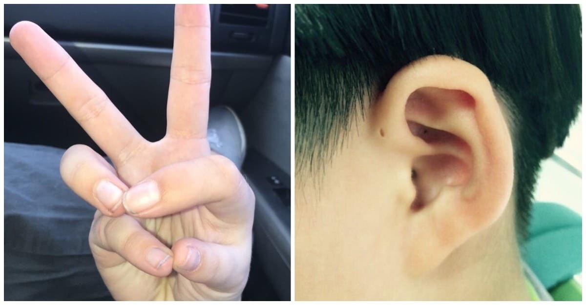 17 people with interesting unique physical qualities