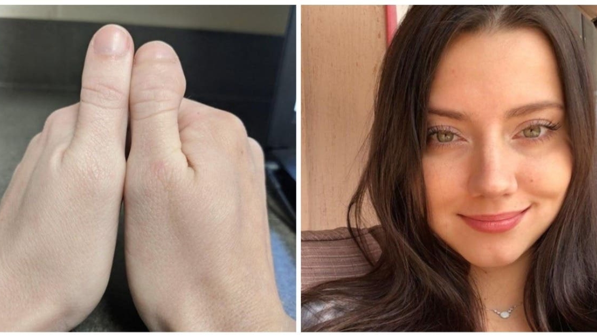 20 people with striking physical characteristics