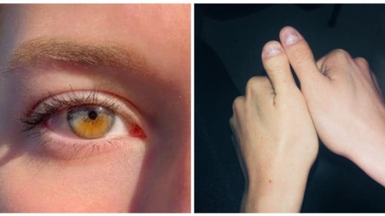 20 people with striking physical traits