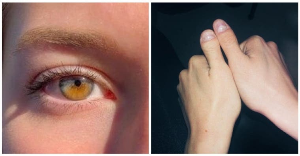 20 people with striking physical traits