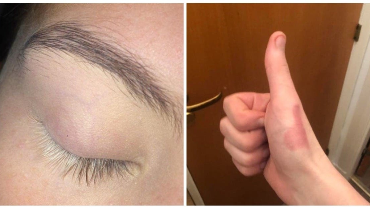 15 people who were born with fascinating physical characteristics